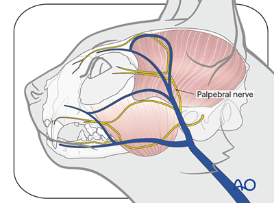 Lateral approach to the temporomandibular joint