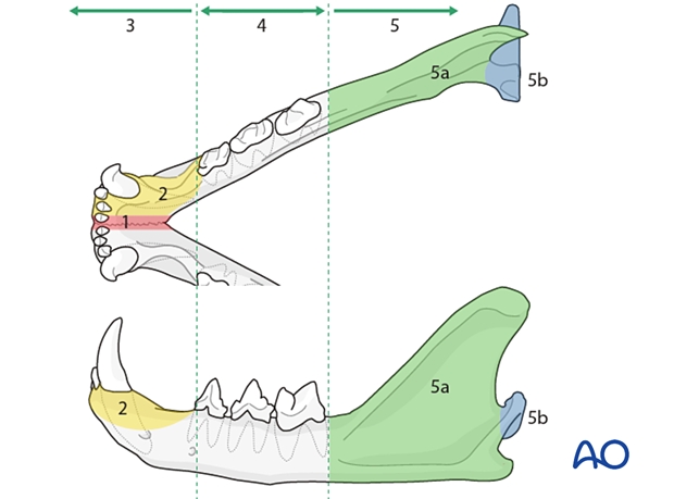 General considerations with mandible fractures