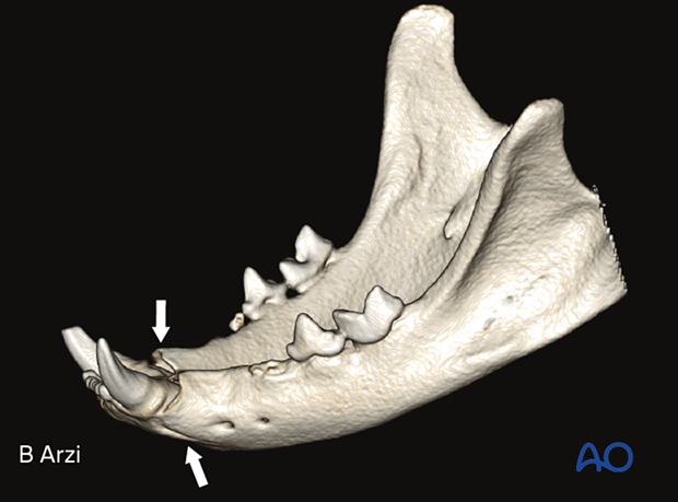 Wire reinforced intraoral splinting for Mandible - Rostral fracture