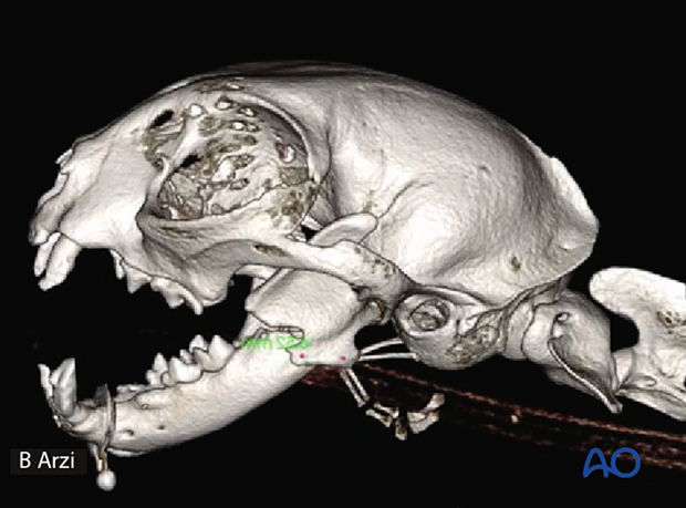 Complications with mandible fractures