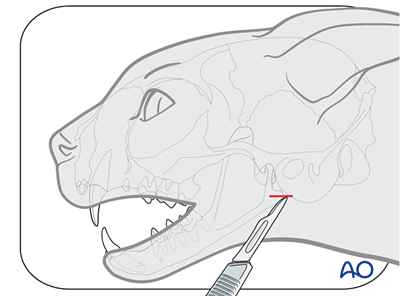 Pharyngotomy intubation