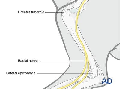 Lateral approach to the dog humeral shaft