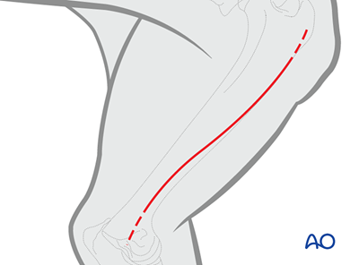Medial approach to the dog humeral shaft