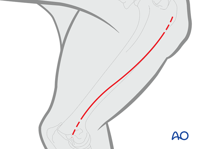 Medial approach to the dog humeral shaft