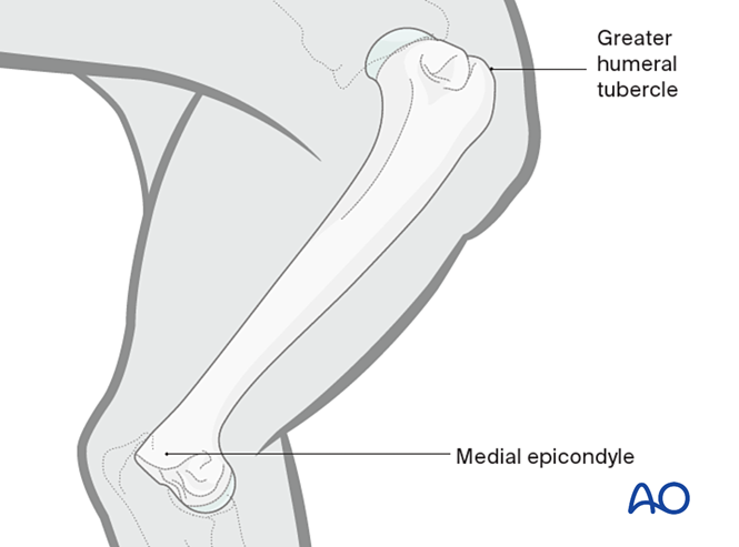 Minimally invasive approach to the dog humeral shaft