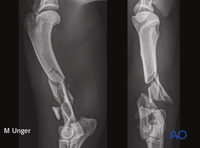 Release notes - Dog humeral shaft