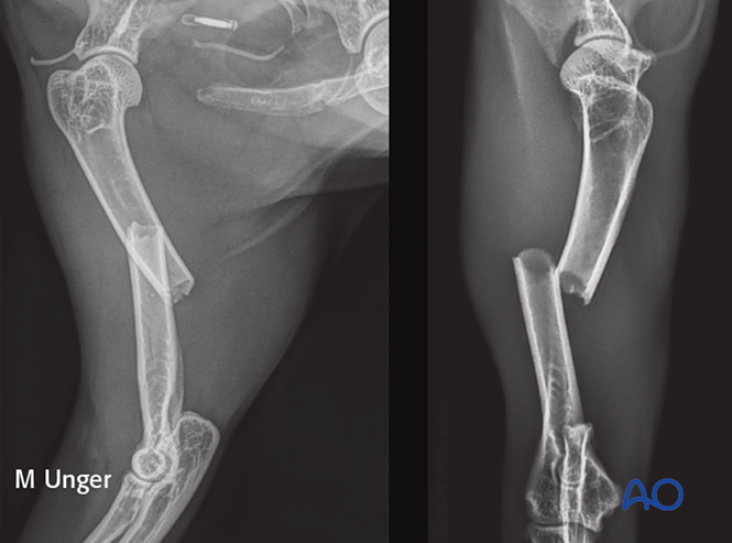 Bridging plate and pin for Dog humeral diaphyseal fracture with complex ...