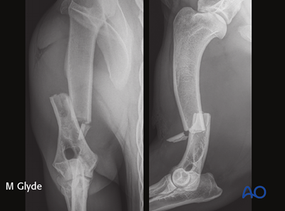 Double plating for Dog humeral diaphyseal fracture with complex non ...