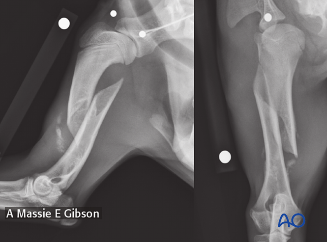 Lag screws and neutralization plate for Dog humeral diaphyseal fracture ...