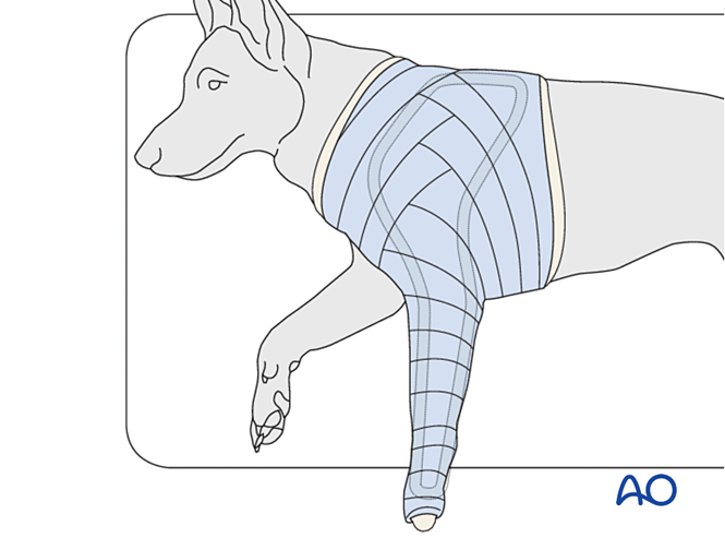 Nonoperative treatment for Incomplete fracture of the dog humeral diaphysis