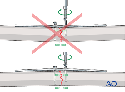 Plate preparation