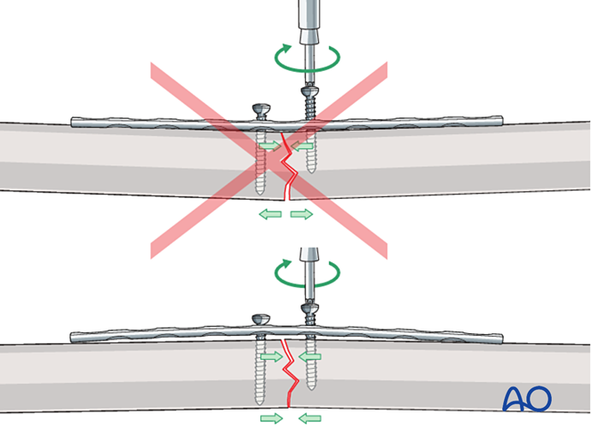 Plate preparation