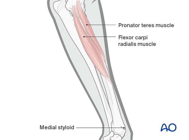 Craniomedial approach to the dog radial shaft