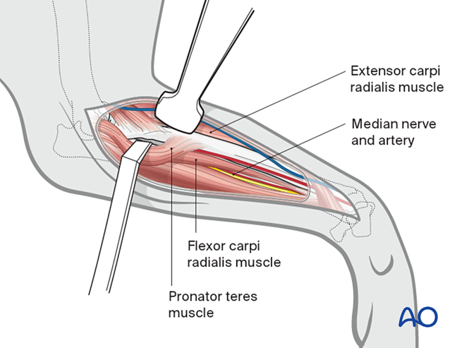 Craniomedial approach to the dog radial shaft