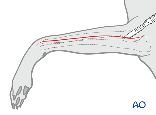 Caudolateral approach to the dog ulnar shaft