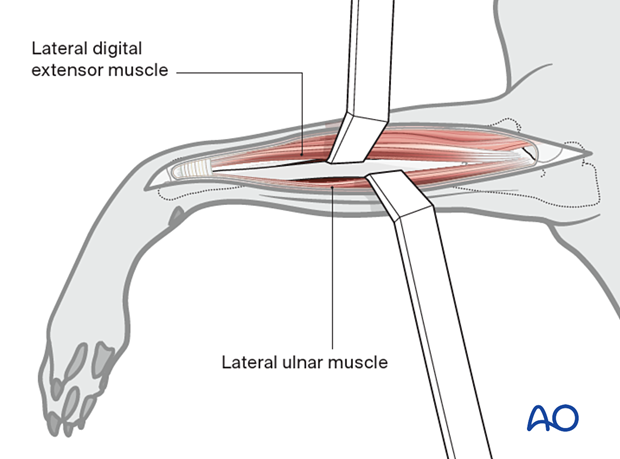 All approaches to the dog radial and ulnar shaft