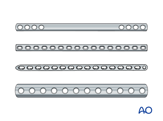 Bridging plate for Wedge fracture of the distal zone of the diaphyseal ...
