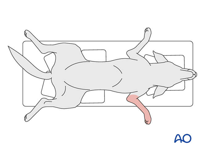Lag screw and neutralization plate on radius with intramedullary pin or ...