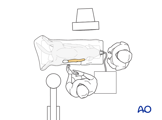 Dorsal recumbency position