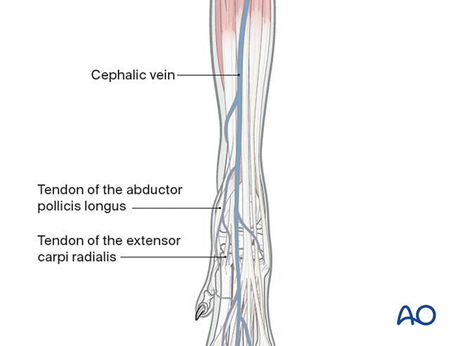Craniomedial approach to the distal radius