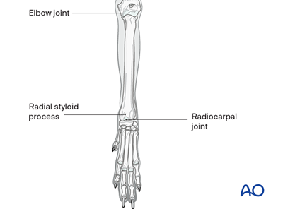 Minimally invasive osteosynthesis approach to the distal radius and ulna