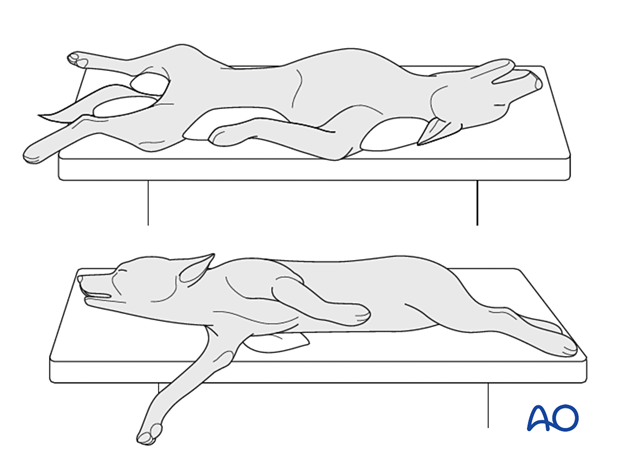 Compression plate fixation for Simple extraarticular fracture of the ...