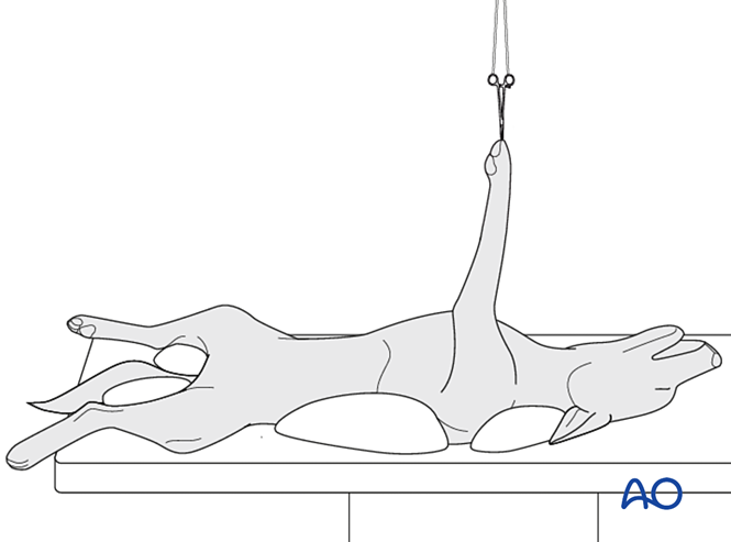 Dorsal recumbency