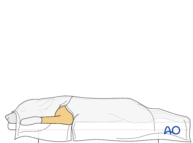 Sternal recumbency