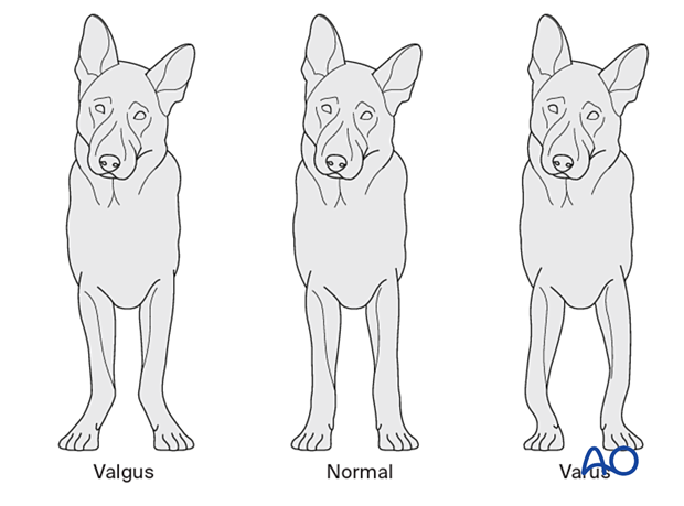 Complications with distal radial and ulnar fractures