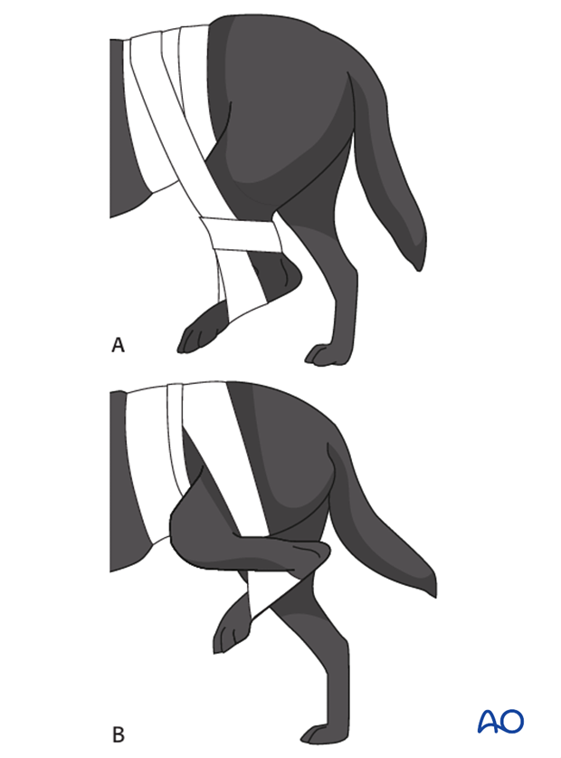 Fragment removal for Capital, articular simple