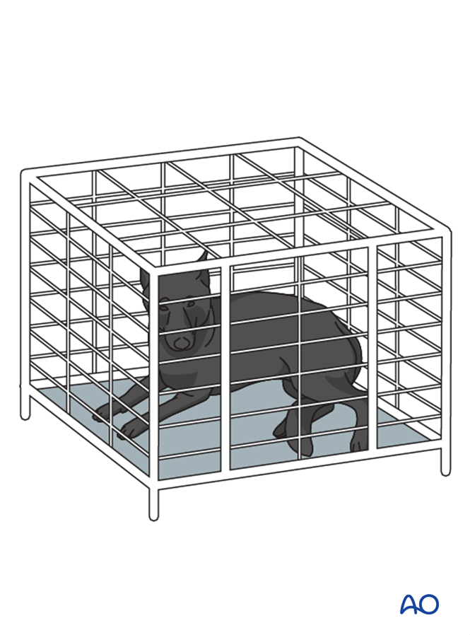 Nonsurgical management for Incomplete fractures of the femoral diaphysis