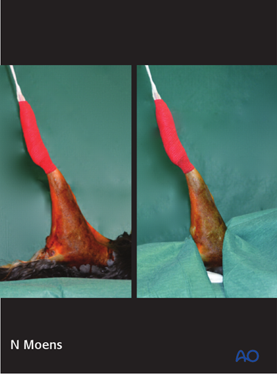 Lateral recumbency position
