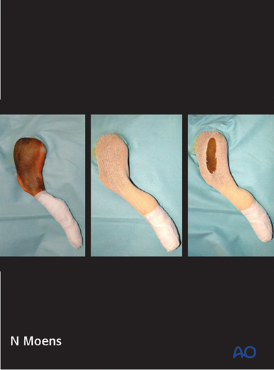 Lateral recumbency position