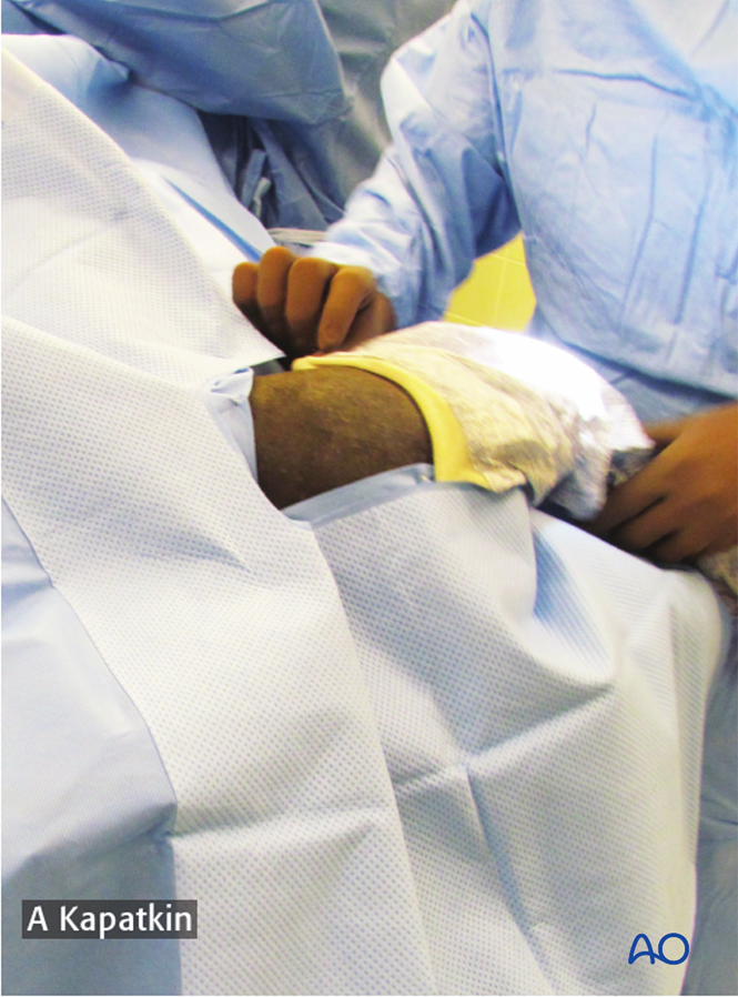 Lateral recumbency position