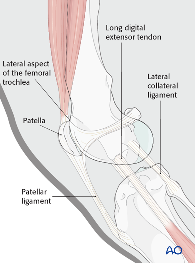 Lateral parapatellar approach to the dog patella