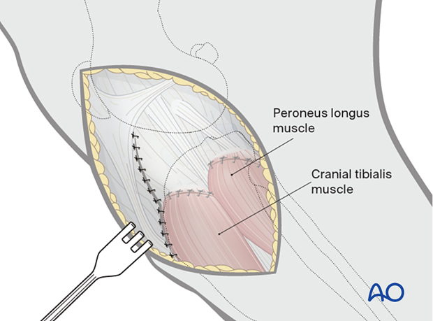 Craniolateral approach to the proximal tibia