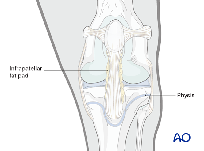 Cranial approach to the dog proximal tibia