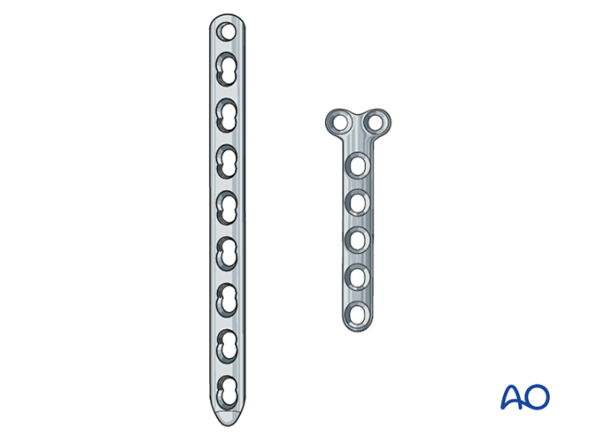 Buttress plate and lag screw with K-wire fixation for Multifragmentary ...