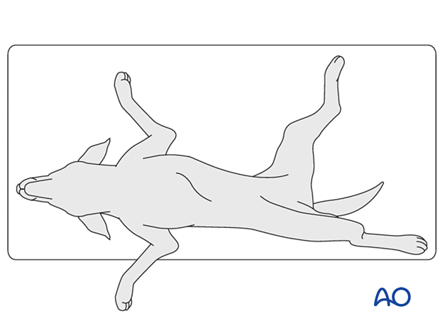 Buttress plate and lag screw with K-wire fixation for Multifragmentary ...