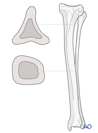Open craniomedial approach (and OBDNT) to the dog tibial shaft