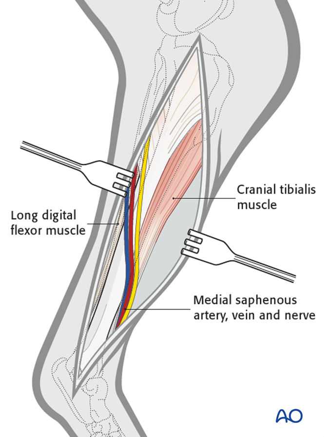 Open craniomedial approach (and OBDNT) to the dog tibial shaft
