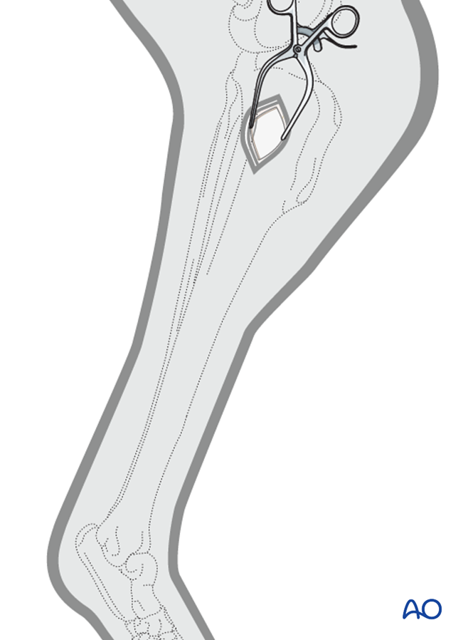 Approaches for minimally invasive osteosynthesis (MIO) to the dog ...