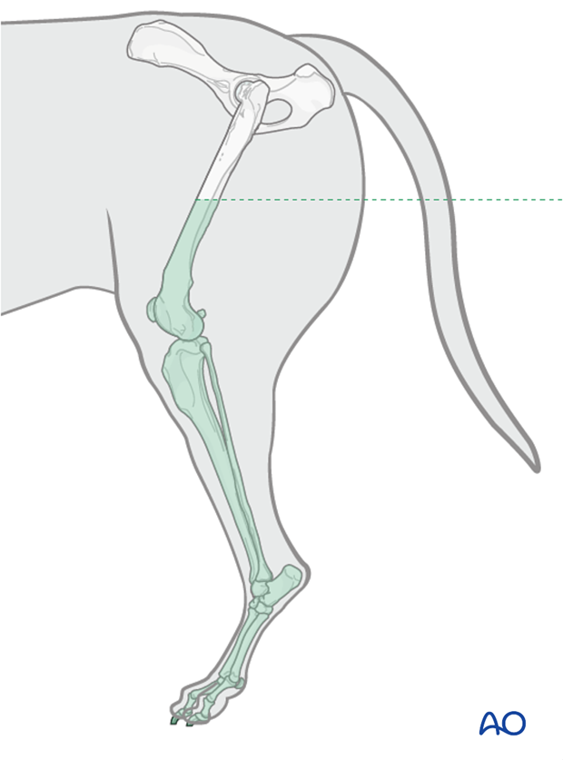 Nonsurgical fracture management for Incomplete fracture of the tibia or ...