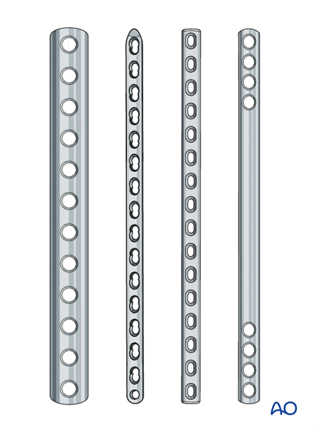 Bridging plate for Nonreducible wedges in the tibial diaphysis