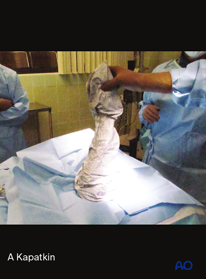 Lateral oblique recumbency