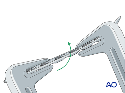 Plate preparation