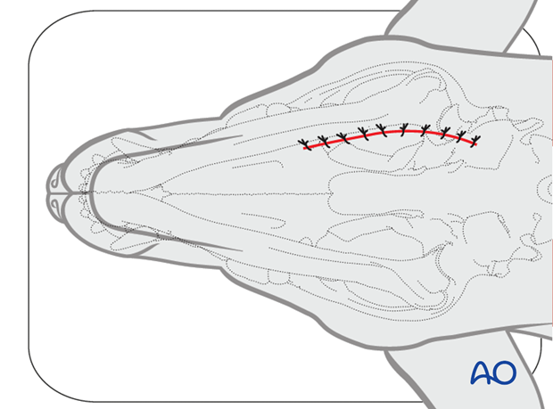 Ventral approach to the caudal mandible