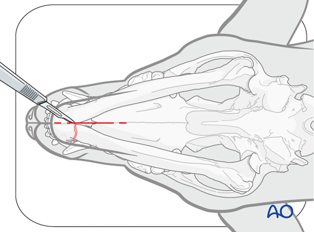Ventral approach to the rostral mandible
