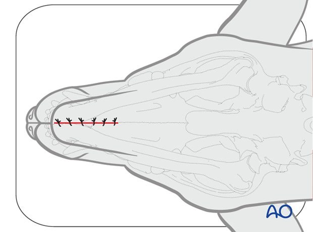 Ventral approach to the rostral mandible