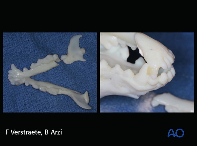 Rostral bilateral simple fracture of the mandible
